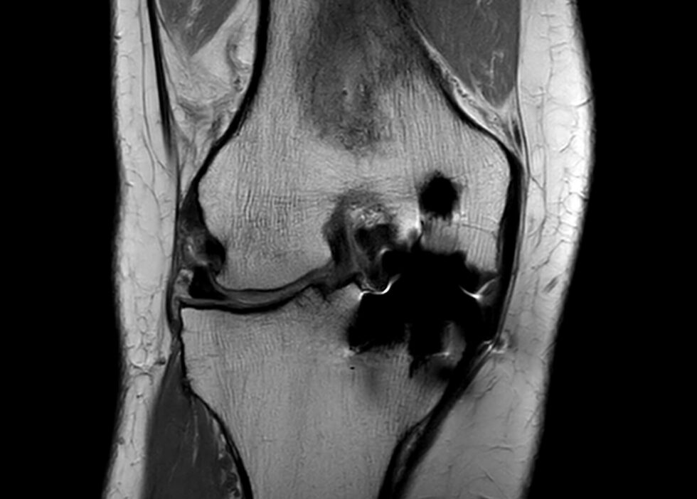 Full Service Imaging Center | ProScan NCH Imaging, Naples FL