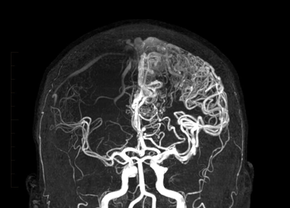 Full Service Imaging Center | ProScan NCH Imaging, Naples FL