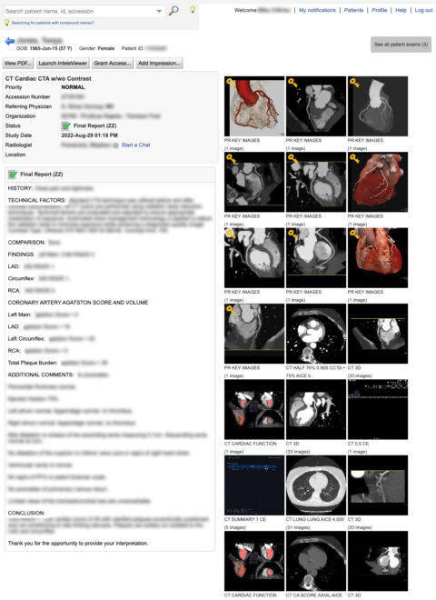 Cardiac Sample Report | ProScan NCH Imaging