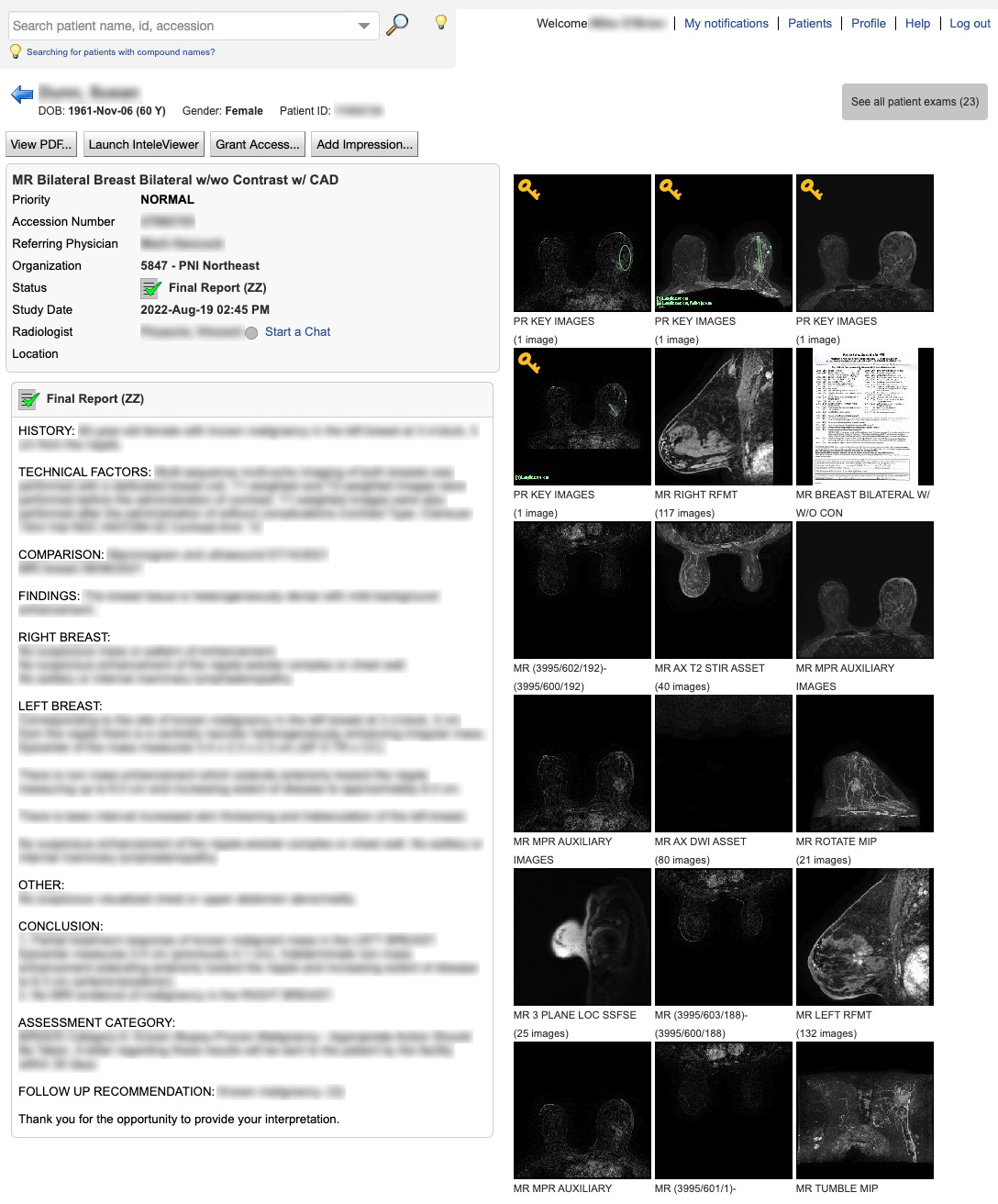 Breast Sample Report | ProScan NCH Imaging