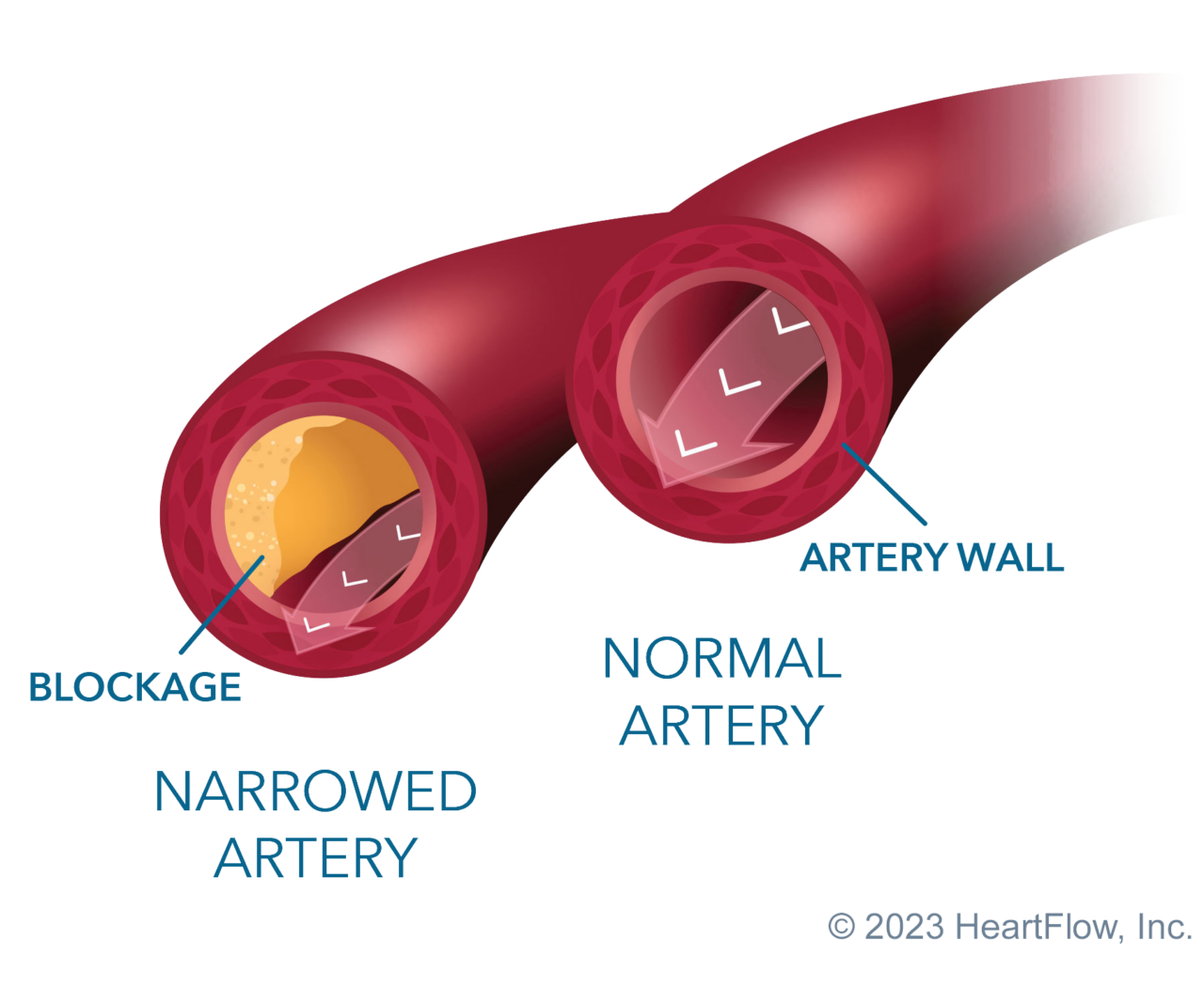 CT Scans | Low Cost CT | ProScan Imaging