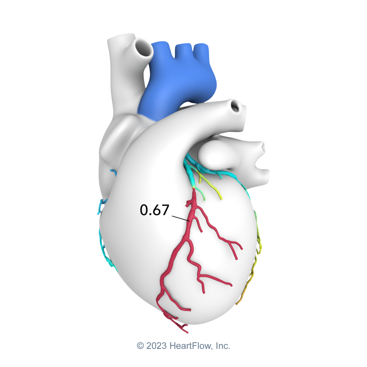 CT Scans | Low Cost CT | ProScan Imaging